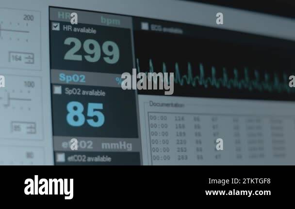Close-up view of the screen of patient monitor displays vital signs ECG ...