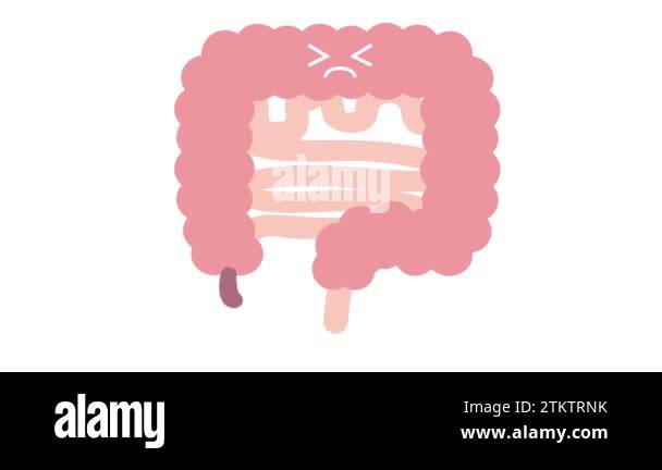Appendicitis Stock Videos & Footage - HD and 4K Video Clips - Alamy