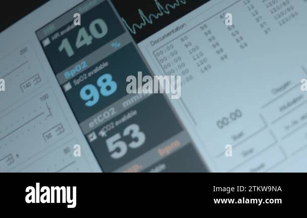 Close-up view of the screen of patient monitor displays vital signs ECG ...