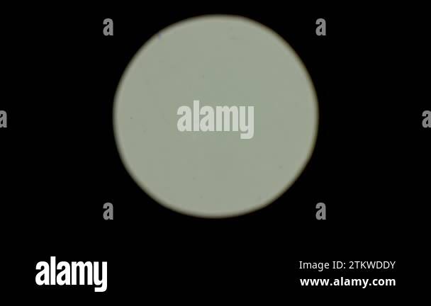 Candida fungus spores under microscope. Candida microorganisms ...