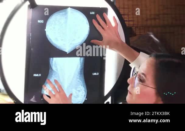 Woman doctor examines on a light box an x-ray study called mastography ...