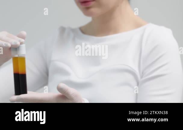 Separated blood sample Stock Videos & Footage - HD and 4K Video Clips ...