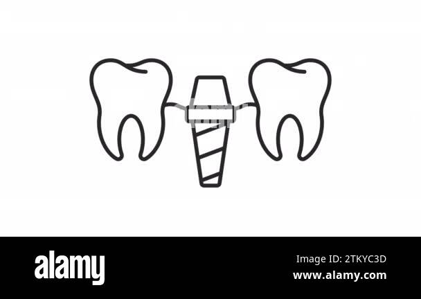 Animated prosthesis linear icon. Endosseous implant. Dental surgery ...