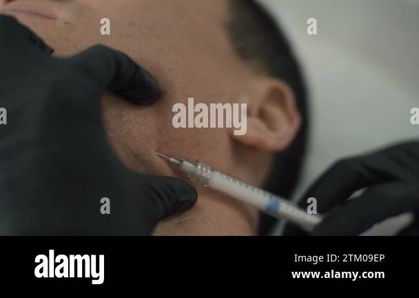 Close-up. Syringe with a needle for injection under the skin of the ...