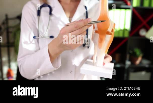 Doctor shows anatomy of structure of human knee joint in clinic ...