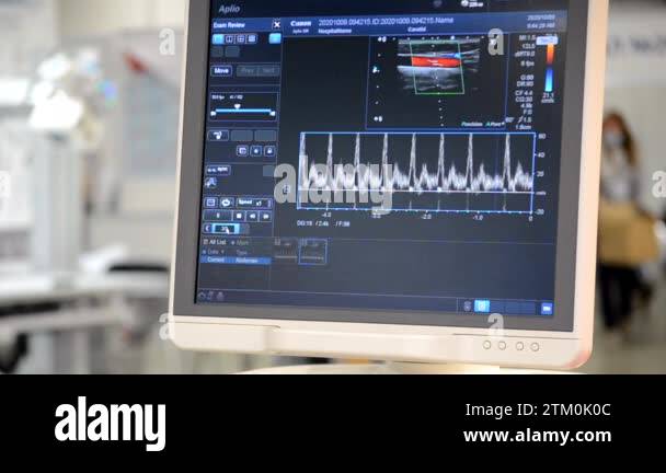Utrasound image on the monitor close-up. Ultrasound Scan display. Using ...