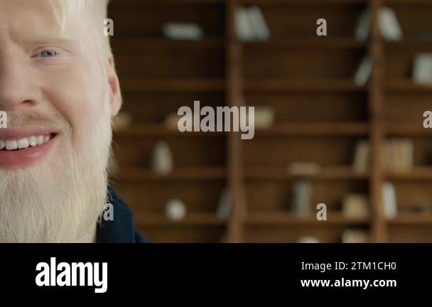 Casual positive albino male for dental background. Close up portrait of ...