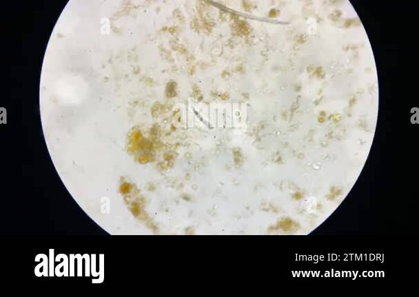 Demodex mange from a microscope view. The parasite causing a skin ...