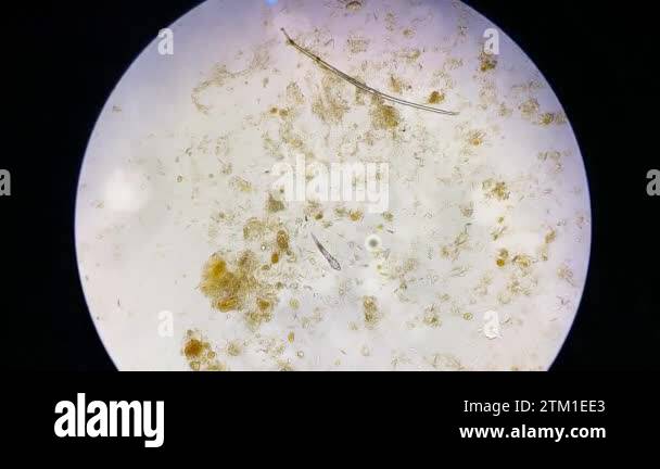 Demodex mange from a microscope view. The parasite causing a skin ...