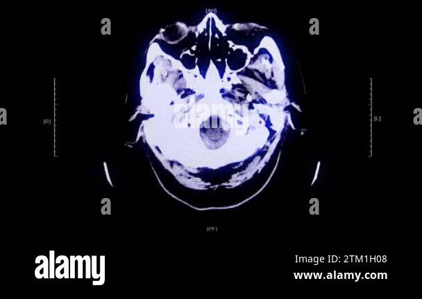 This stock motion graphics pack features Medical Brain Cat Scans ...