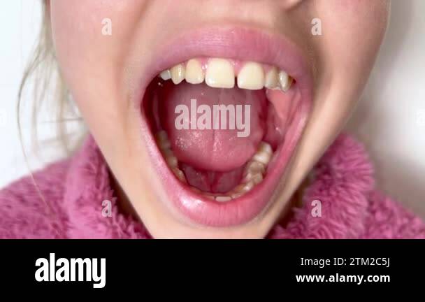 Child girl or teenage girl of eleven years old opens the mouth wide and ...