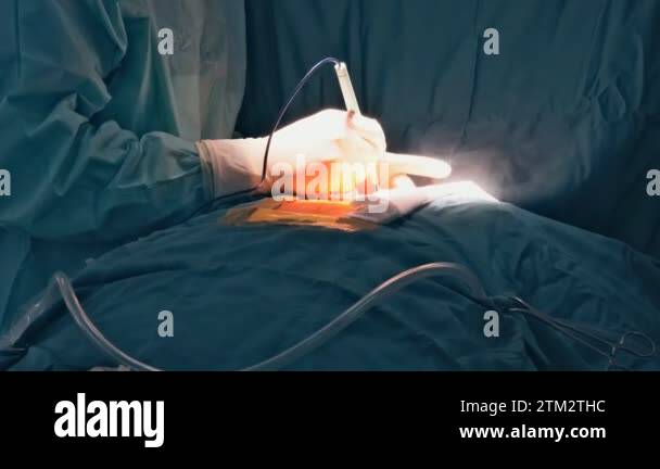 Heart dissection Stock Videos & Footage - HD and 4K Video Clips - Alamy