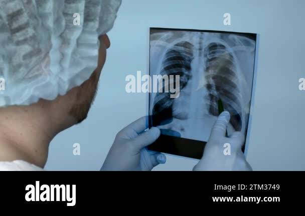 Close-up, Doctor with lung x-ray. A doctor carefully analyzes an x-ray ... Close-up, Doctor with lung x-ray. A doctor carefully analyzes an x-ray ...