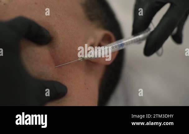 Close-up. Syringe with a needle for injection under the skin of the ...