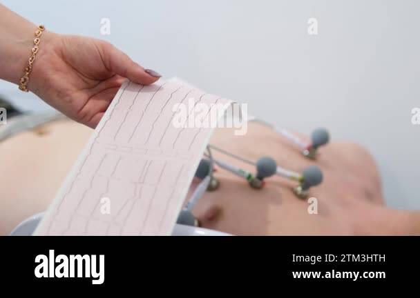 cardiogram in the hospital woman doctor examines a man patient puts ...