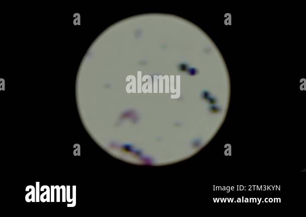 Analyses using microscope. Bacteria on slide under the microscope ...
