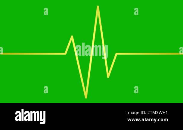 Animated golden line of electrocardiogram. Linear symbol of pulsating ...