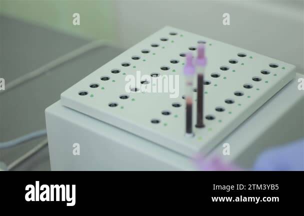 Nurse puts a modern test tube with the blood analysis in a support ...