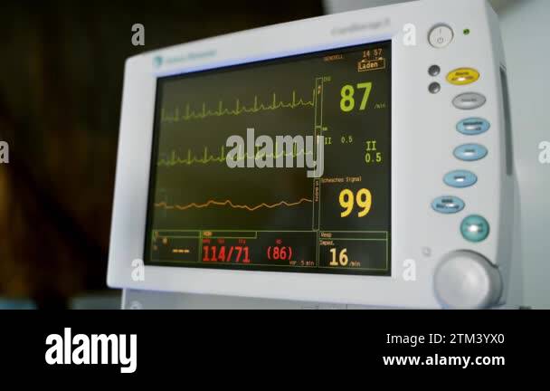 Monitor displays vital signs of a patient. Electrocardiogram on the ...