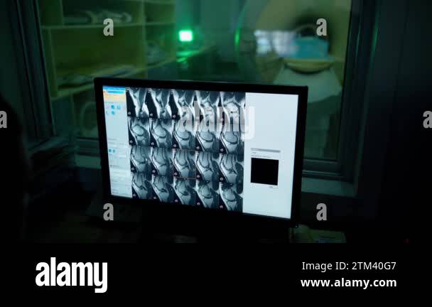 Radiology x ray Stock Videos & Footage - HD and 4K Video Clips - Alamy