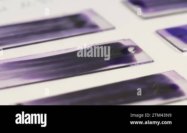 Left to right shot of microscope slides with samples. Using reagent for ...