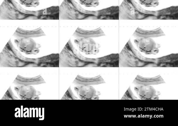 Child anatomy computer illustration Stock Videos & Footage - HD and 4K ...
