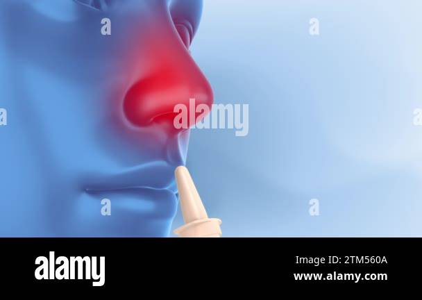 Clearing cold with decongestant nasal spray Stock Video Footage - Alamy