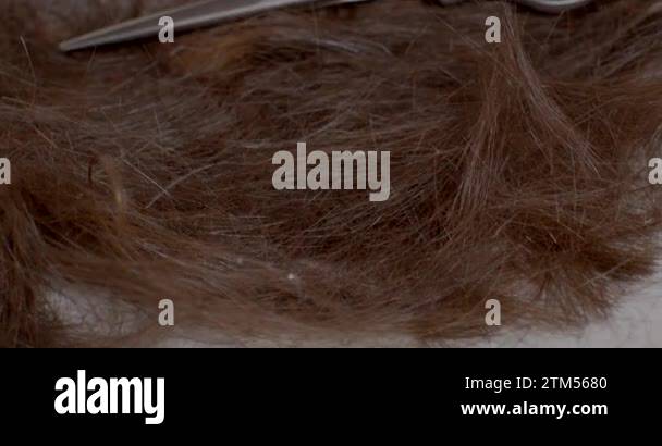 Hair infested nits Stock Videos & Footage - HD and 4K Video Clips - Alamy