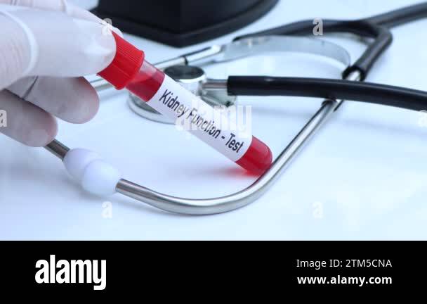 kidney function test to look for abnormalities from blood, blood sample ...