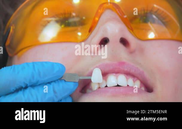 Girl patient and dentures teeth shade selection. Dentist selecting ...