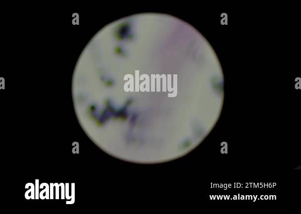 Selective focus shot of a staphylococcus bacteria on slide under the ...