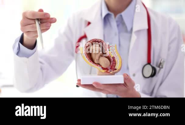 Doctor with stethoscope points pen to realistic model of uterus with ...