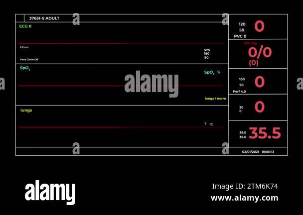 Critical temperature and pressure Stock Videos & Footage - HD and 4K ...