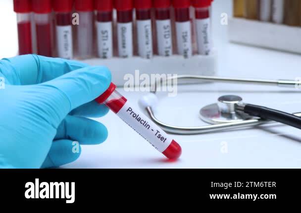 Prolactin test to look for abnormalities from blood, blood sample to ...