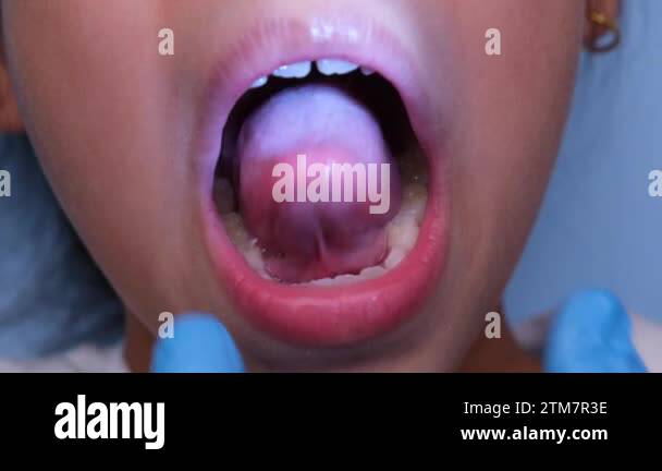 Close-up inside the oral cavity of a healthy child with beautiful rows ...
