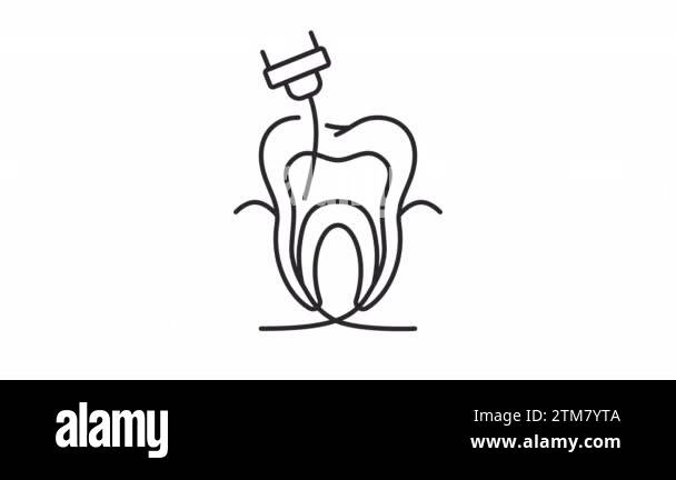 Animated endodontics linear icon. Dental pulp treatment. Obturation ...