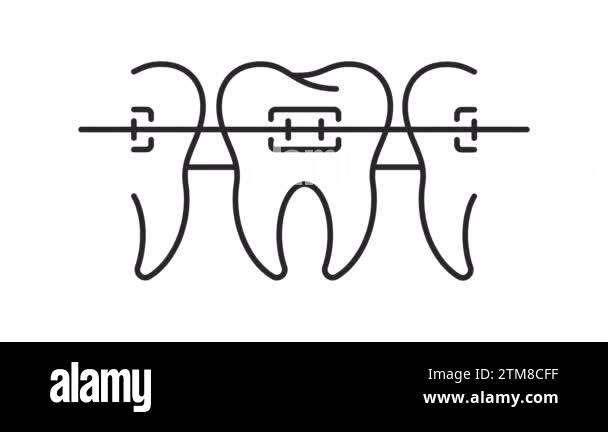 Animated braces linear icon. Orthodontic procedure. Dentistry. Teeth ...
