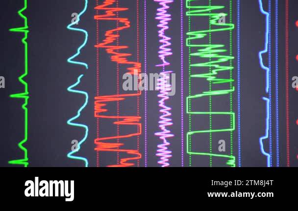 Modern patient monitor. Electronic Health Monitor displaying medical ...