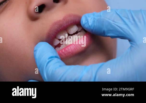 Close-up inside the oral cavity of a healthy child with beautiful rows ...