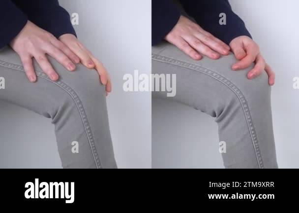 Before and after. Woman has severe knee pain. Ruptured knee tendons ...