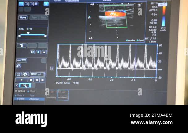 Modern patient monitor. Electronic Health Monitor displaying medical ...