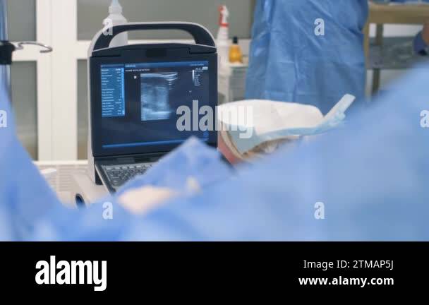 Monitoring of vital functions of the body during cardiosurgical ...