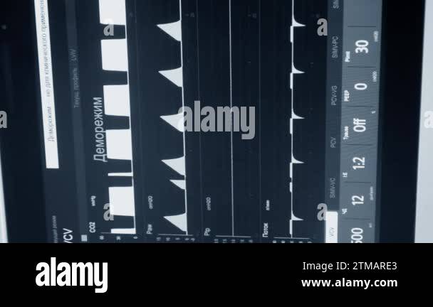 Patient monitor close-up. Monitor with different patient vital signs in ...