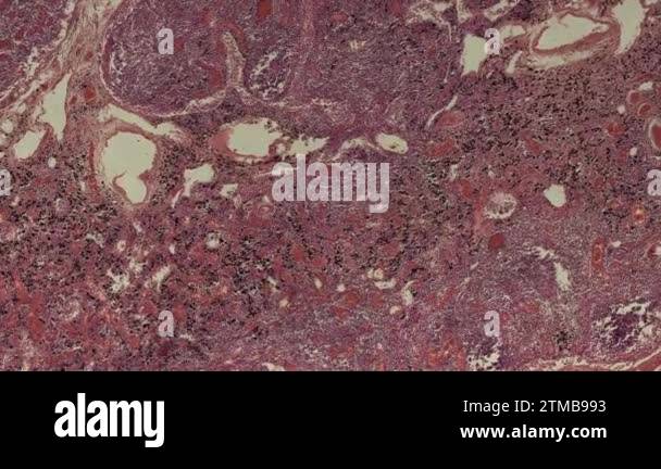 Take a look at human body cells under a scientific microscope animation ...