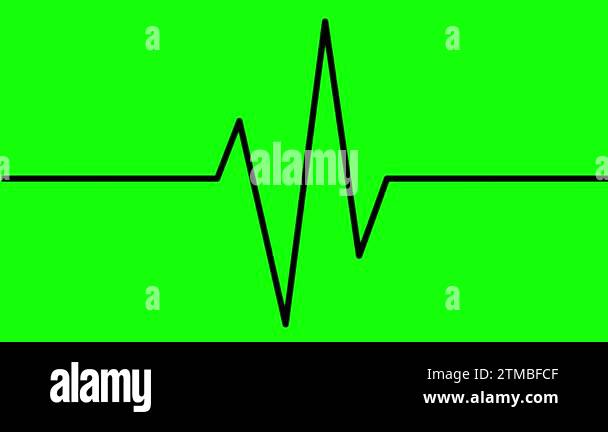 Animated black line of electrocardiogram. Linear symbol of pulsating ...
