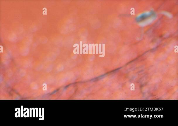 Artist concept rendering, microscopic image, medical nano robotic ...
