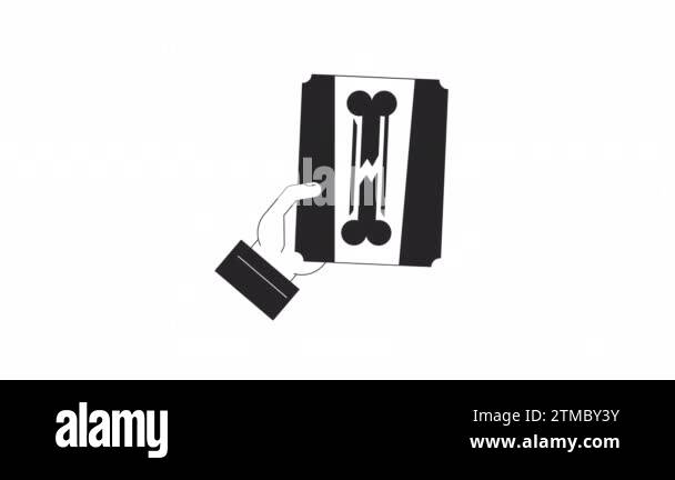 Holding bone x ray scan bw animation. Orthopedic trauma isolated 2D ...