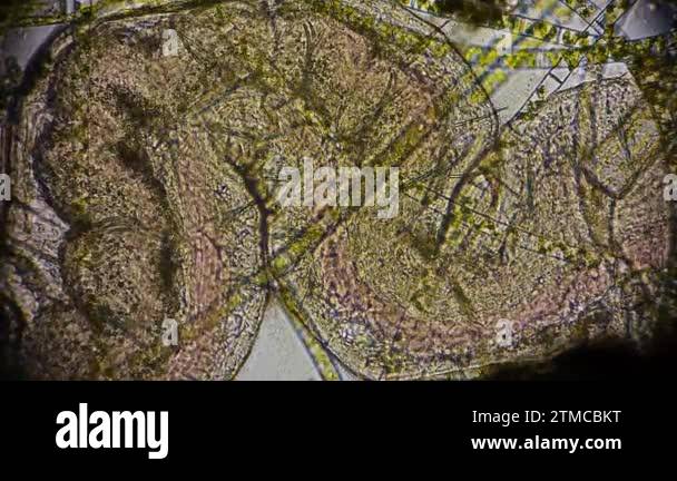 take a look at microorganism under the microscope video clip Stock ...