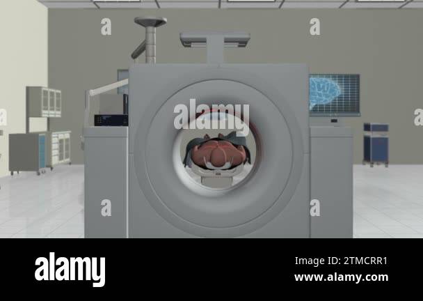 MRI Scan, Camera Fly Through and stop on Brain Scan Stock Video Footage ...