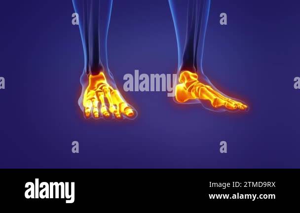 Human heel anatomy Stock Videos & Footage - HD and 4K Video Clips - Alamy